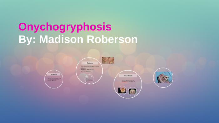 Onychogryphosis by Madison Roberson