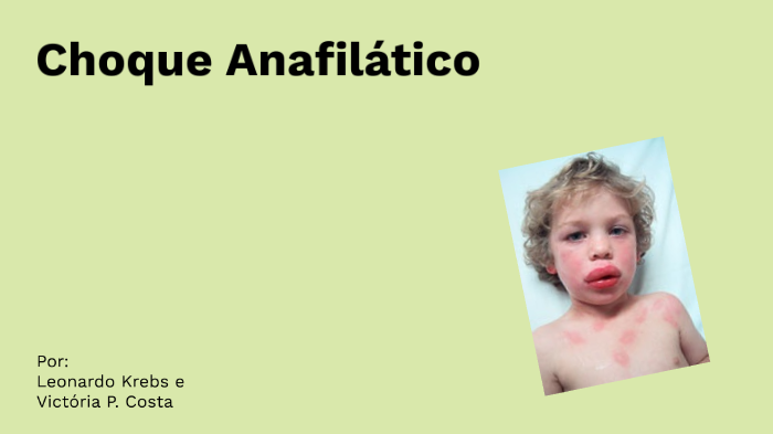choque anafilático by LEONARDO KREBS on Prezi