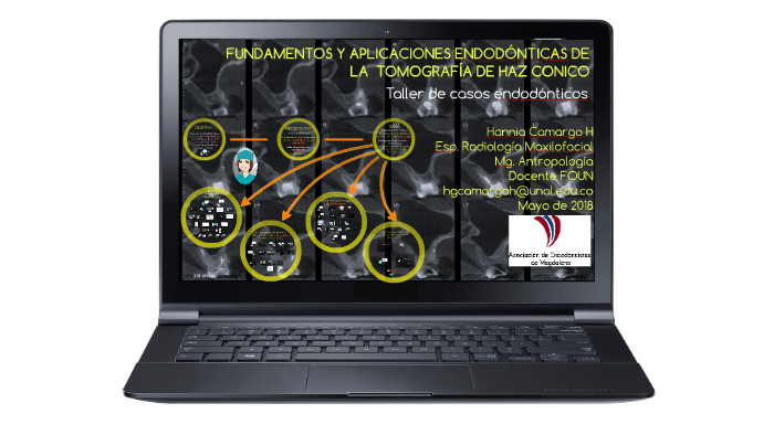 ENDO STA MARTHA 2018 by hannia camargo on Prezi