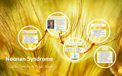 Noonan Syndrome by Megan Daigle on Prezi