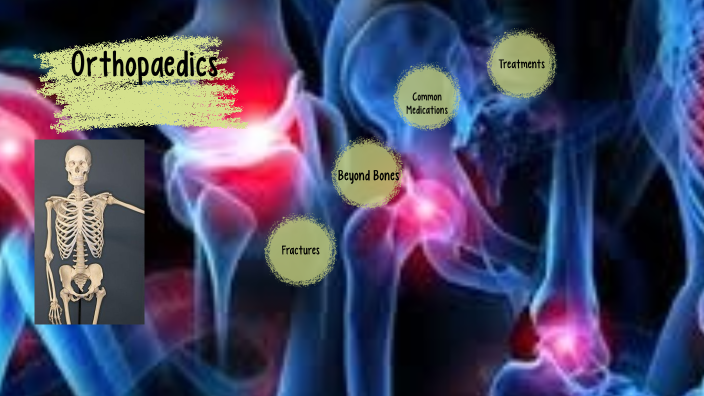 Orthopaedics by Shelley MacKay on Prezi