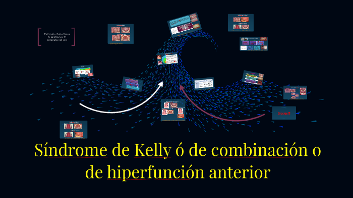 Sindrome Combinado de Kelly by angela maria andrews camargo on Prezi