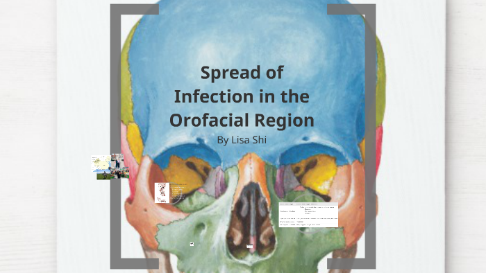 Spread of Infection in the Orofacial Region by Lisa Shi on Prezi