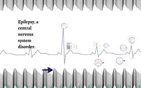 Epilepsy, a central nervous system disorder. by george king on Prezi