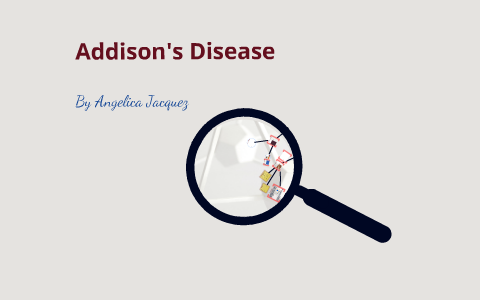 Addisons Disease by Angelica Jacquez