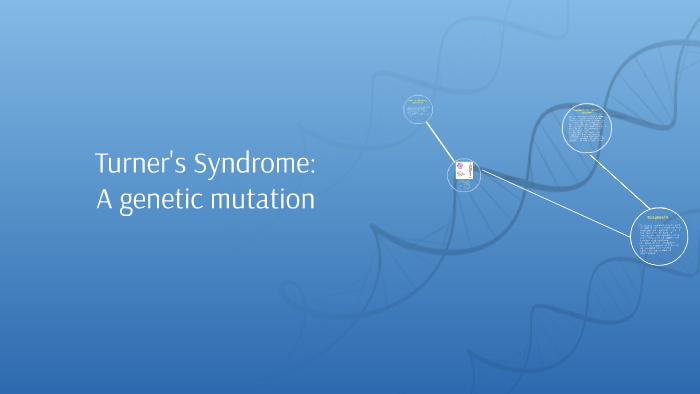 Tuner's Syndrome by Niamh Orr-Walker
