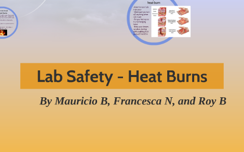 Lab Safety - Heat Burns by Francesca Noe on Prezi