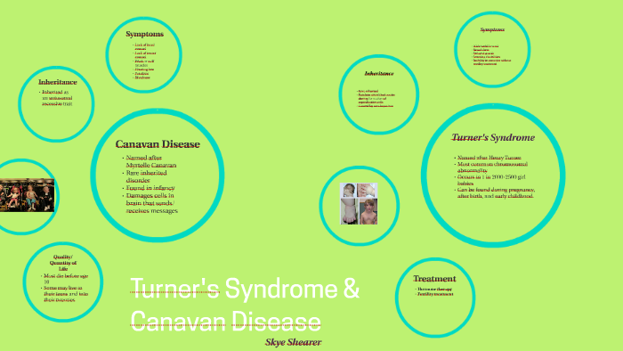 Turner Syndrome and Canavan Disease by Skye Shearer on Prezi
