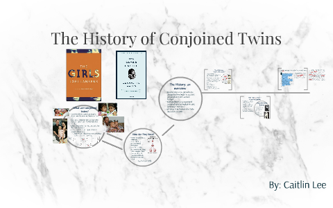 The History of Conjoined Twins by Caitlin Lee on Prezi