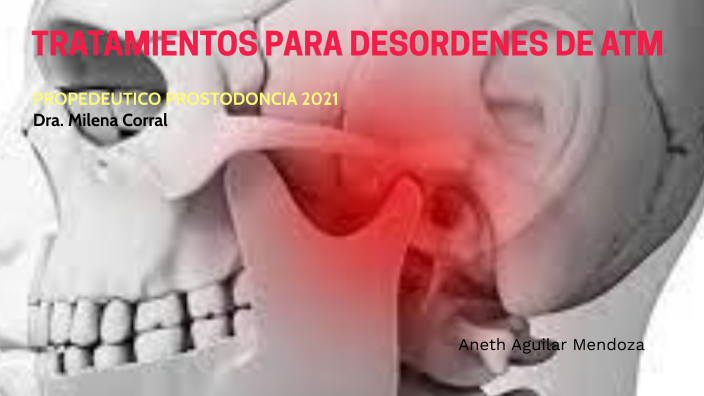TRATAMIENTOS PARA DESORDENES DE ATM by Aneth Aguilar on Prezi