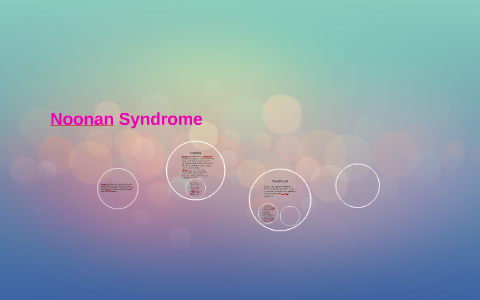 Noonan Syndrome by lashawn jackson on Prezi