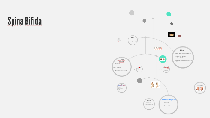 Spina Bifida by Jamie Nicole on Prezi