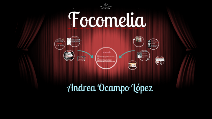 Focomelia by andrea ocampo