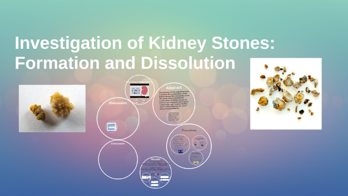 Investigation of Kidney Stone Formation and Dissolution by Everest ...