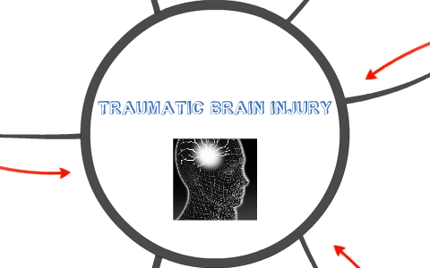 TBI by heather zeitlin on Prezi