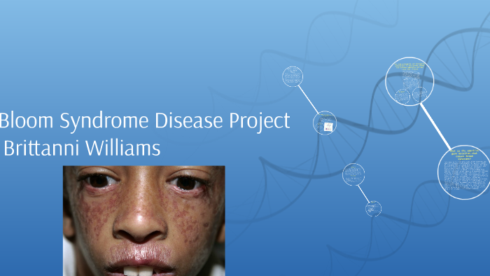 Bloom Syndrome by brittanni williams