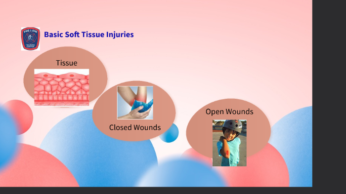 Basic Soft Tissue Injuries (EMT) by Kenneth Sternig on Prezi