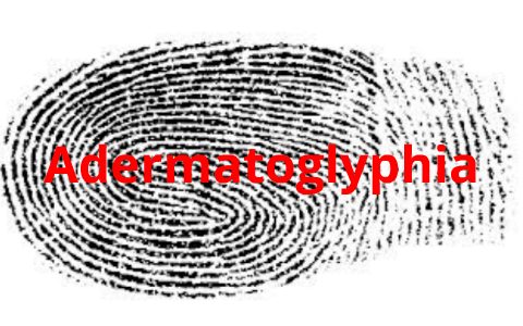 Adermatoglyphia by Kirsten Ramirez on Prezi