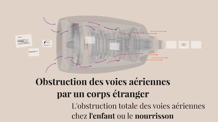 Obstruction des voies aériennes by C Julie on Prezi