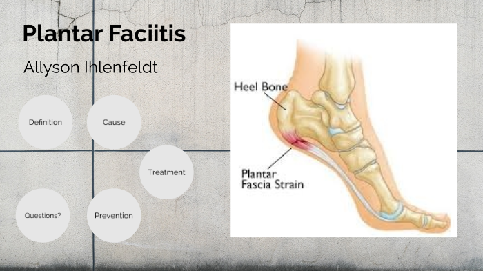 Plantar Fasiitis by Allyson Ihlenfeldt on Prezi