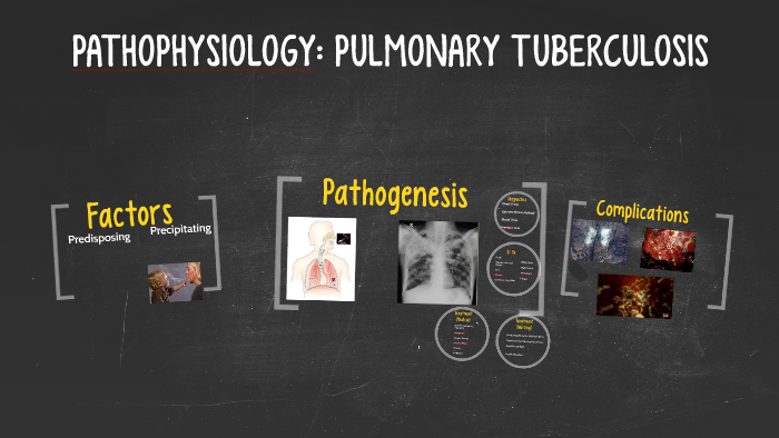 PATHOPHYSIOLOGY: PULMONARY TUBERCULOSIS by Kevin Carl Quilang on Prezi