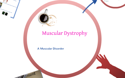 Muscular System Diseases and Disorders by lynnae Frisco on Prezi