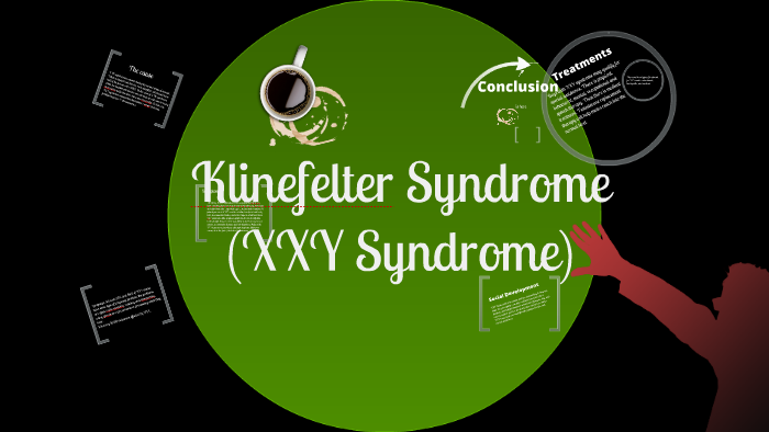 Klinefelter Syndrome (XXY syndrome) by Val Mongo on Prezi