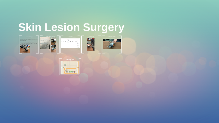 Skin Lesion Surgery by