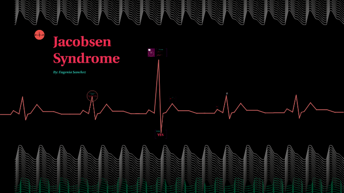jacobsen syndrome by on Prezi
