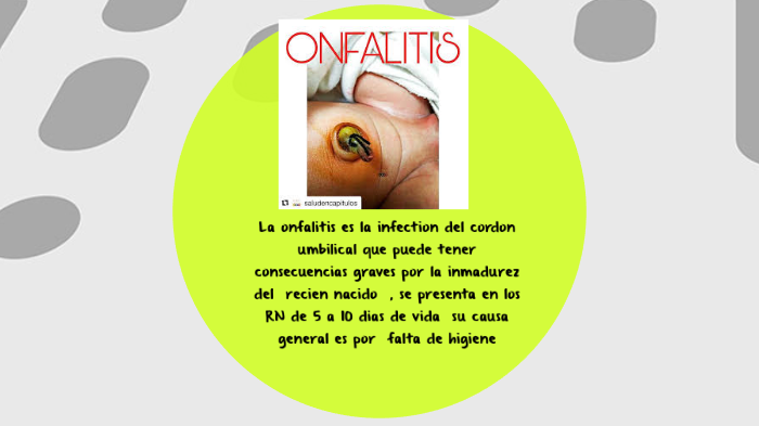 ONFALITIS by PAOLA VERA on Prezi