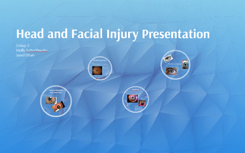 Head and Facial Injury Presentation by Jared Olsen on Prezi