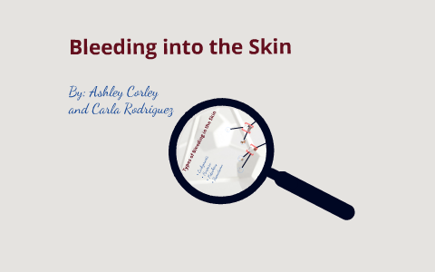 Bleeding into the Skin (Med Term) by Carla Rodriguez on Prezi