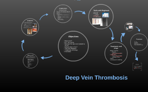 Deep Vein Thrombosis Prophylaxis by Patrick McMullen on Prezi