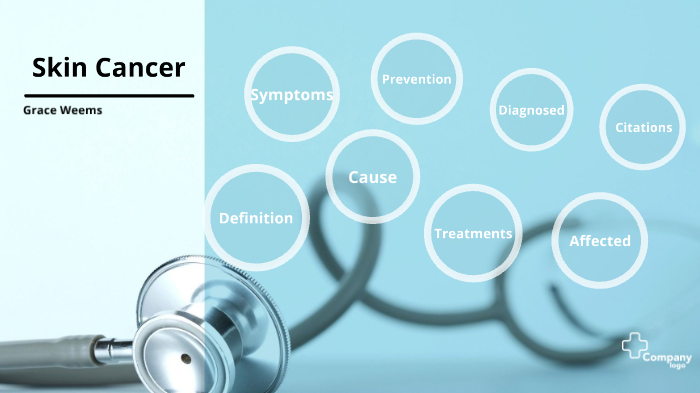 Science project on skin cancer by Grace Weems on Prezi