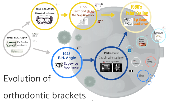 Evolution of orthodontic brackets by Nizam Muhamad on Prezi