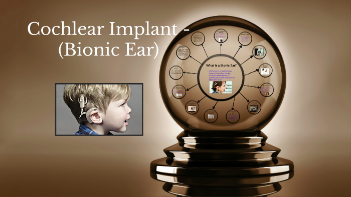 Cochlear Implant (Bionic Ear) by Nawal Saleh on Prezi