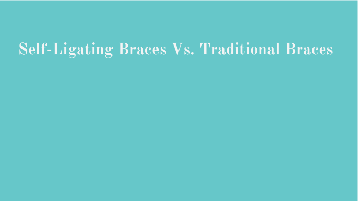 Self-Ligating Braces Vs. Traditional Braces by Trejo Fuentes on Prezi