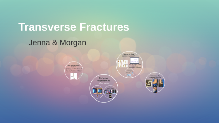 Transverse Fractures by Morgan H on Prezi