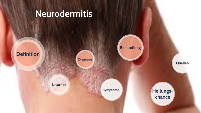 Neurodermitis by Evelina Petker on Prezi