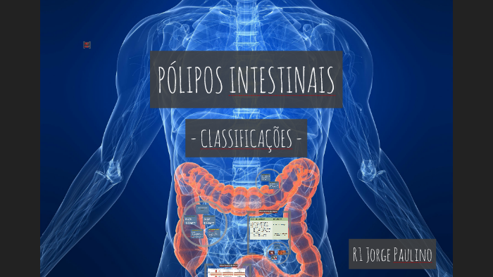 PÓLIPOS by Jorge Assis