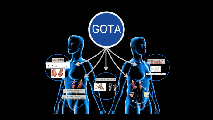GOTA by on Prezi