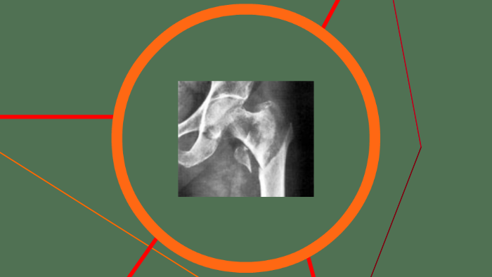 Danelias-Miller Mehod vs Clements-Kakayama Method by Amber Blackwelder ...