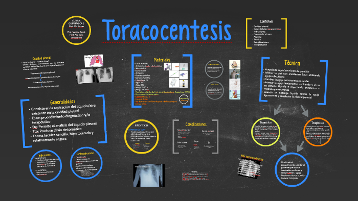 Toracocentesis by Maria Ines Umpierrez on Prezi