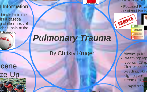 Pulmonary Trauma by christy beauregard on Prezi