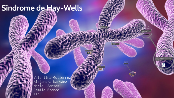 Síndrome de Hay- Wells by valentina gutierrez