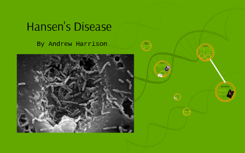 Hansen's Disease by Andrew harrison on Prezi