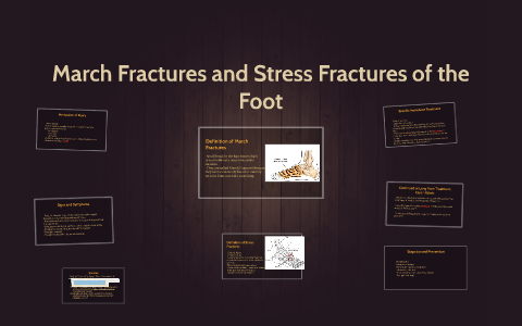 March Fractures and Stress Fractures of the Foot by Kelcie Bormann on Prezi