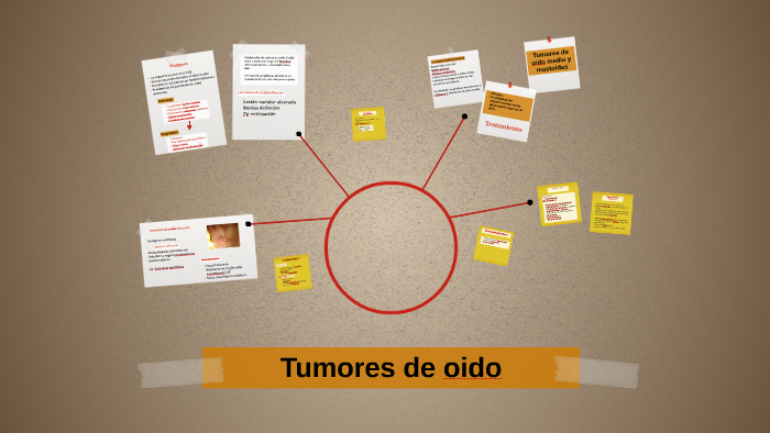 Tumores de oido by lilian camargo on Prezi
