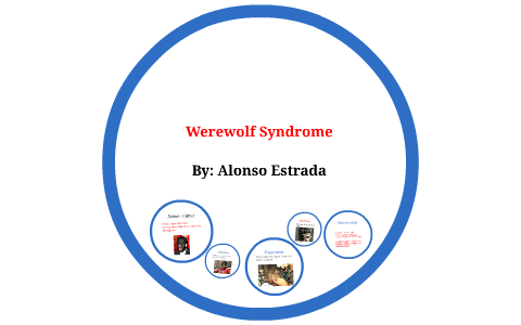 Werewolf Syndrome by Alonso Estrada on Prezi
