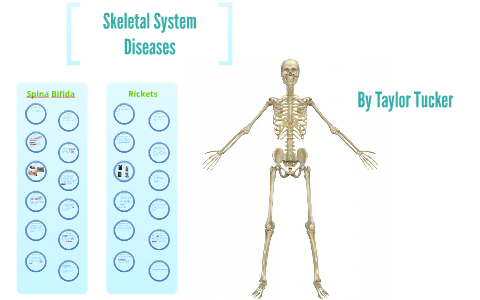 Skeletal System Diseases by on Prezi